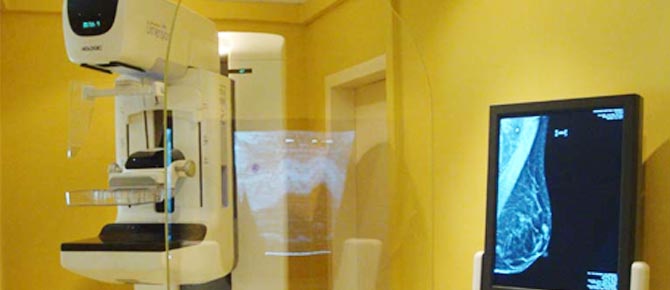 Tomosintesis | Unidades | Centro Patología de la Mama | CPM-Tejerina.com